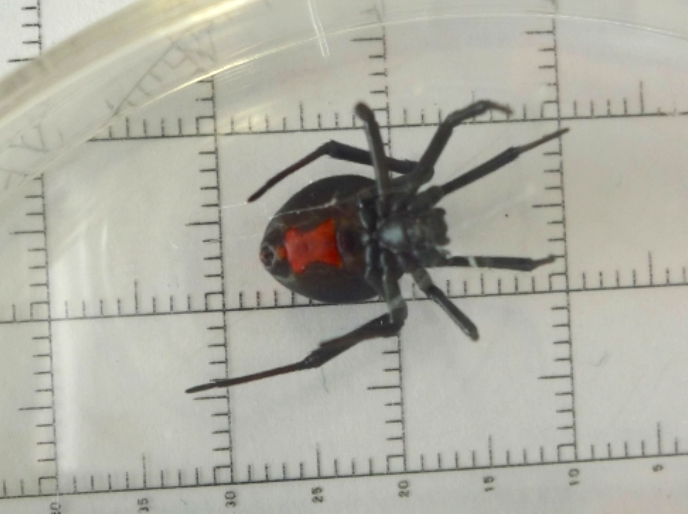 Four-Year-Old Bitten By Redback Spider At Kitakyushu Daycare | Fukuoka Now